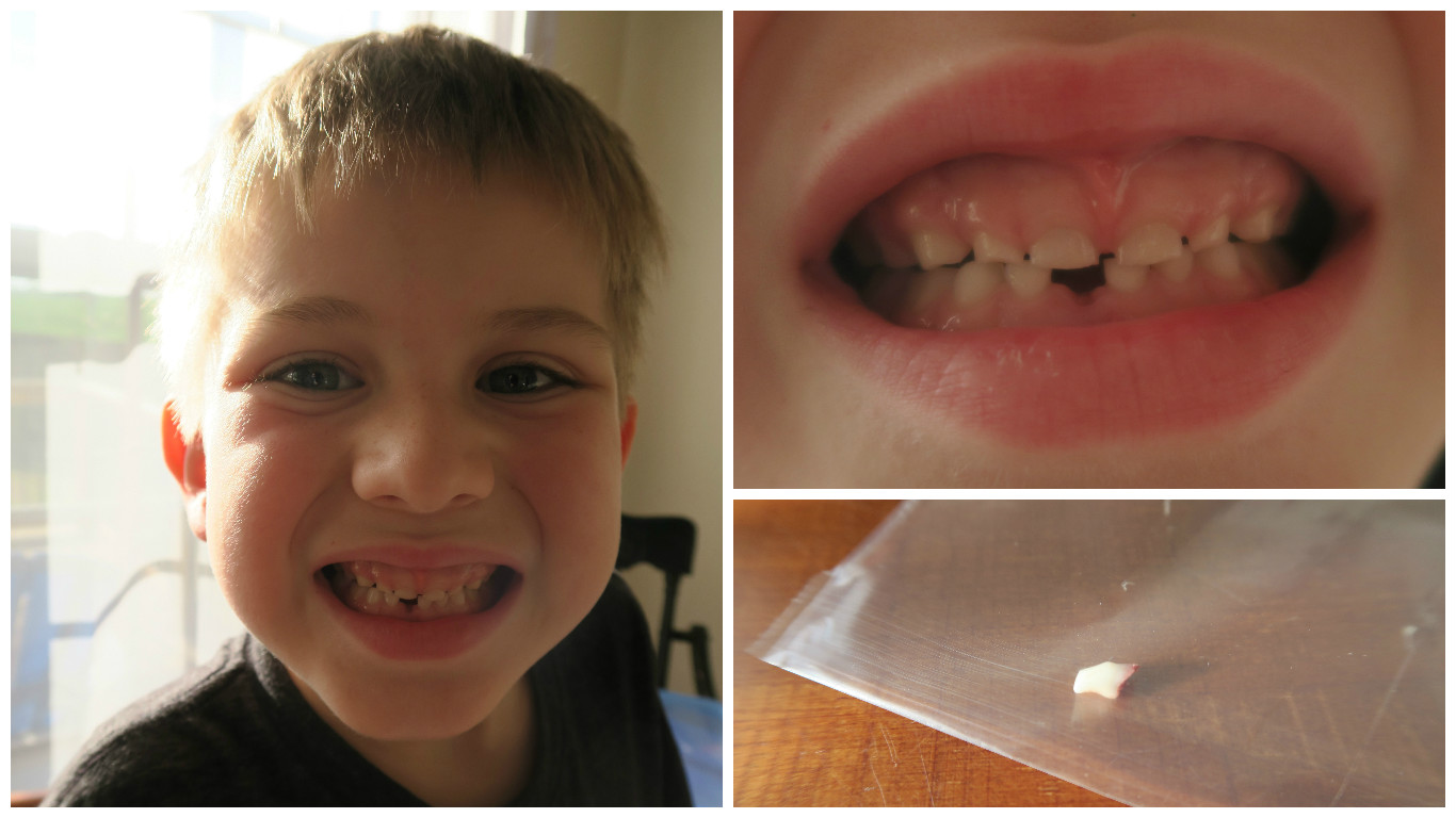 Dear Jack: You Lost Your 1st Tooth… and So Did the Tooth Fairy ...